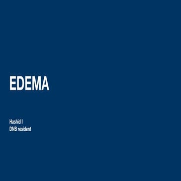 Edema pathogenesis,causes, approach.pptx