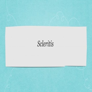 scleritis and episcleritis powerpoint for reading | PPTX