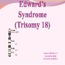 Edward’s syndrome (Trisomy 18) | PPTX