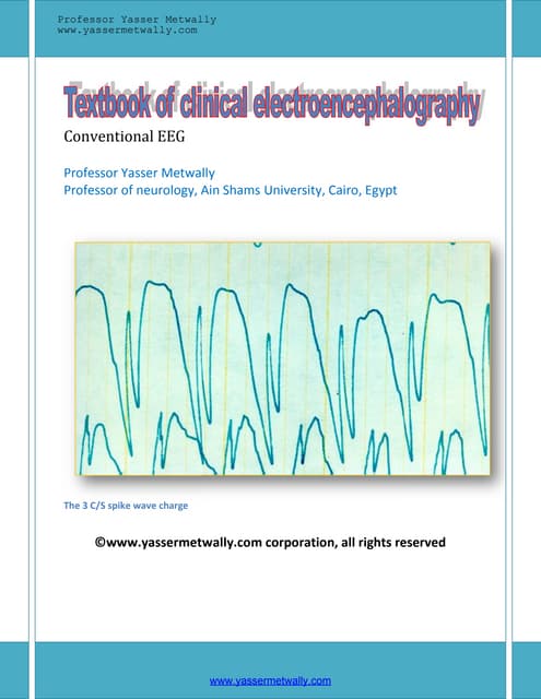 EEG (electroencephalogram) | PPTX
