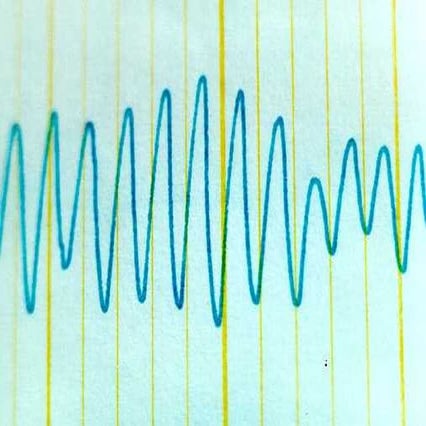 Definition of Some conventional EEG terminologies | PPT