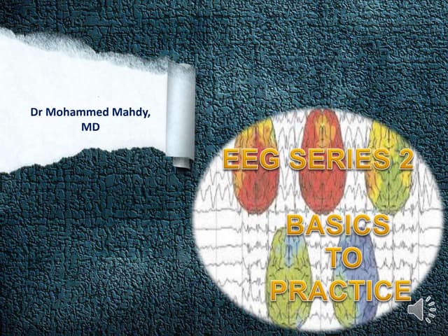 Positive Occipital Sharp Transients of Sleep, Posterior slow-wave ...