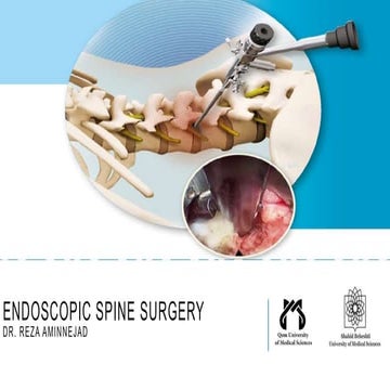 Extraforaminal PELD | PPT