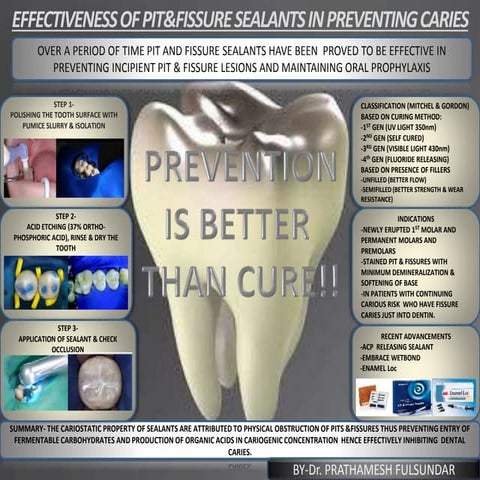 Pit and Fissure sealants | PPTX