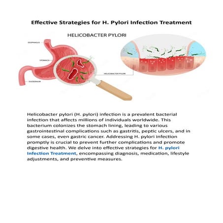 Effective Strategies for H Pylori Infection Treatment.pdf