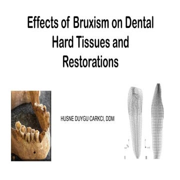 Effects of Bruxism on Dental Hard Tissues and Restorations PP ...