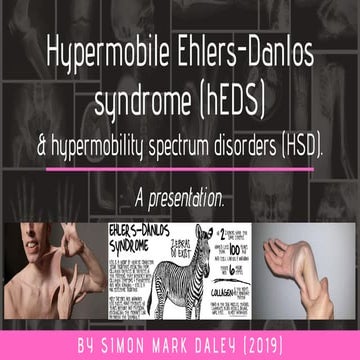 Hypermobile Ehlers-Danlos Syndrome & hypermobility spectrum disorders ...