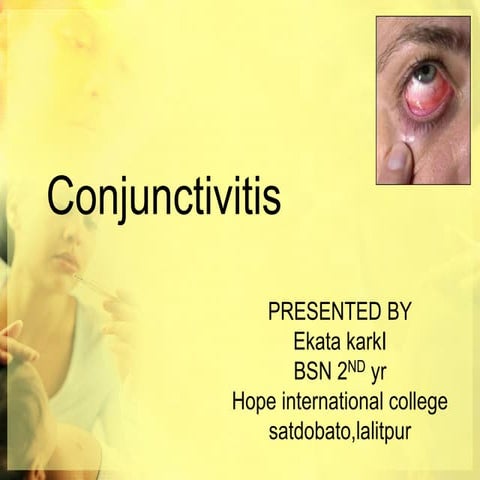 conjunctivitis | PPTX