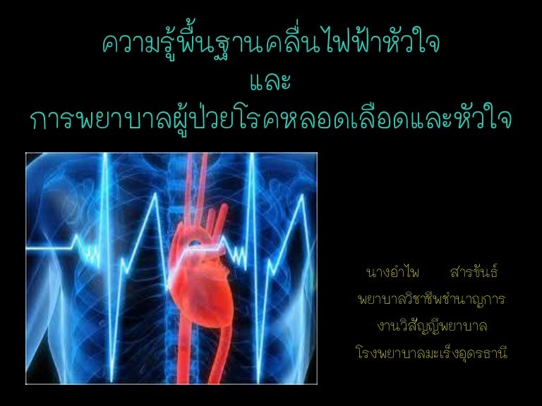 การอ่านค่า Ekg