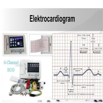 smt-4-Interpretasi-EKG.pdf