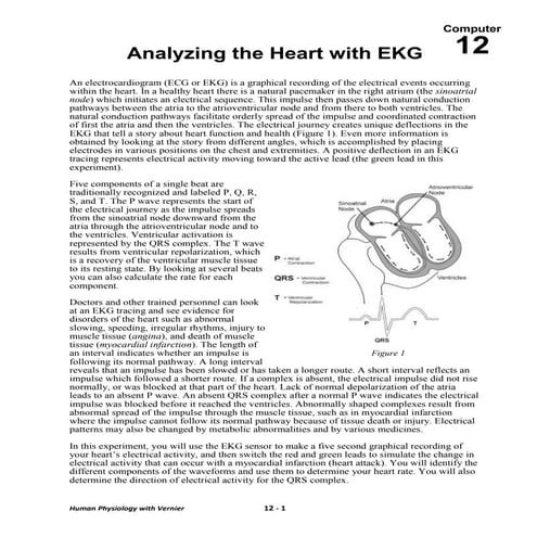 Ekg lab 3 | DOCX