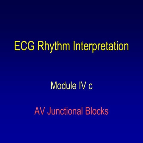 Ekg module 4c | PPT