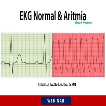 EKG Normal & Aritmia dari II Ismail UNTUK PESERTA .pdf