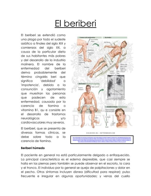 Beriberi | PDF