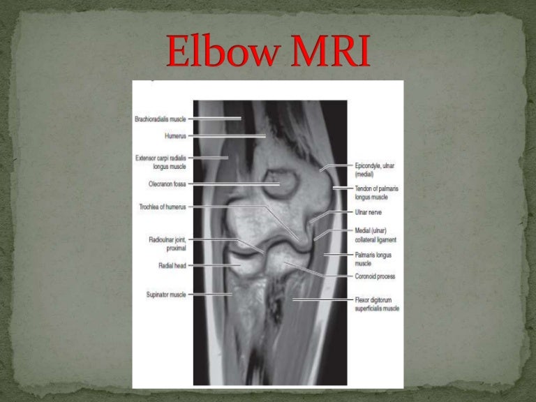 Mri Elbow Positioning