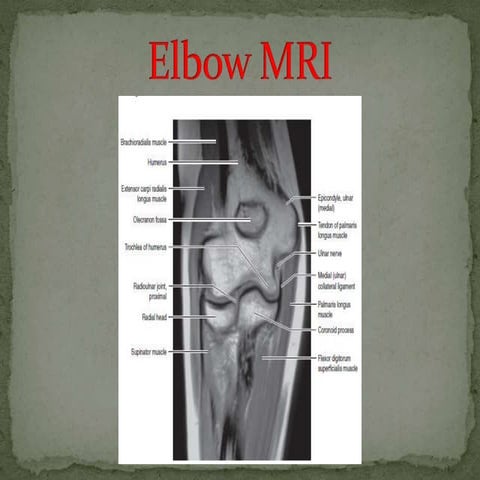 Elbow MRI | PPTX