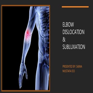 Elbow dislocation and subluxation | PPTX