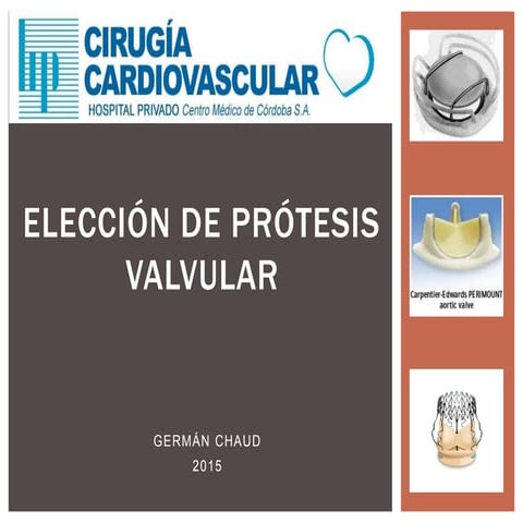 Prótesis valvulares | PPTX