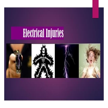 electric shock .pptx