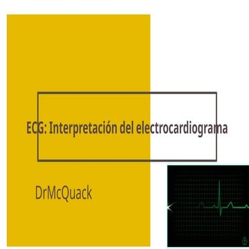 interpretación de lectura de electrocardiograma | PPTX