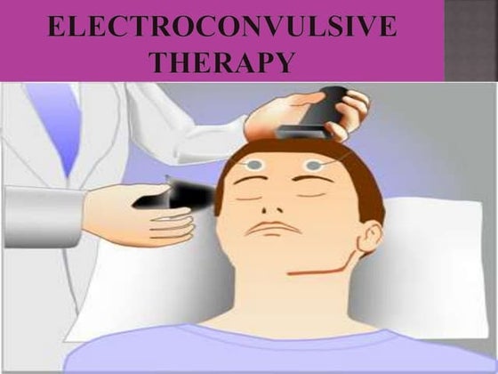 Electroconvulsive therapy (ECT) | PPT