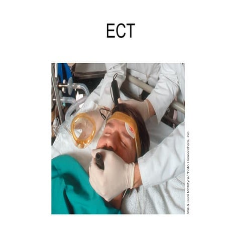 Electroconvulsive therapy.ppt in mental health nursing | PPT