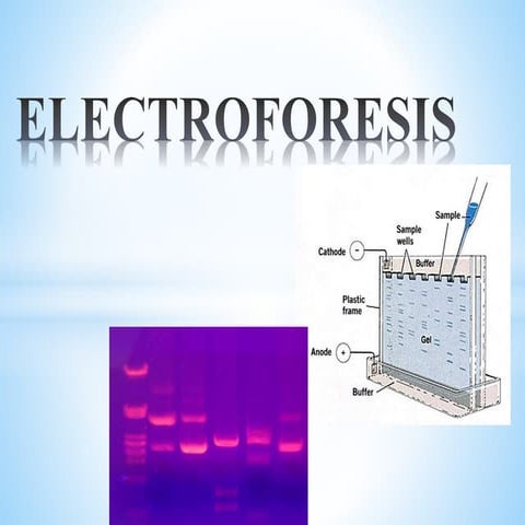 estudio de la electroforesis en gel de agarosa | PPTX