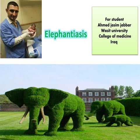 Elephantiasis | PPTX