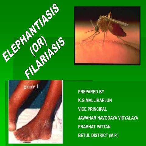 Elephantiasis presentation1 | PPSX