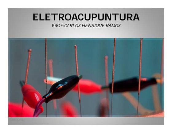 Estimulação elétrica nervosa transcutânea (TENS) | PPT