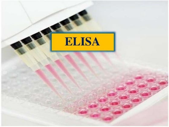 ELISA- Principle, Types and Applications.pptx
