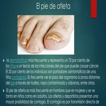Pie de atleta | PPT
