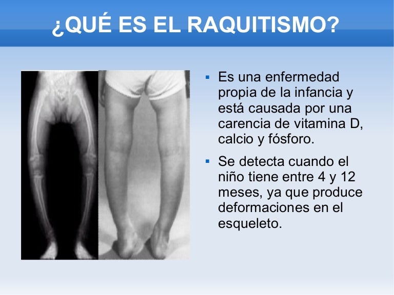 Despojo a la raquítica soldada que percibe la mujer / cruzgomez.es