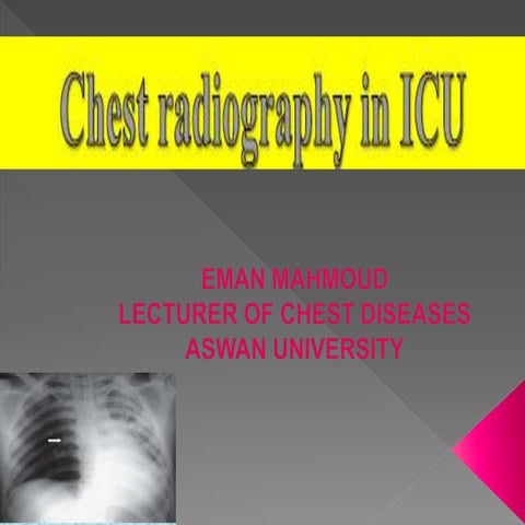chest radiology in ICU | PPTX