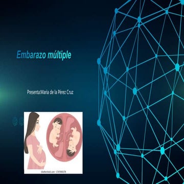 Diagrama De Embarazo De Trillizos