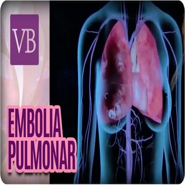Embolia pulmonar | PPTX