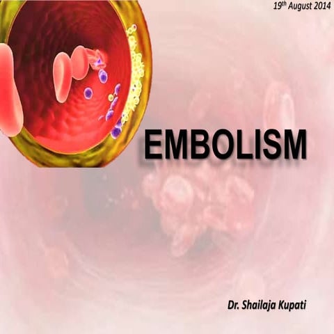 EMBOLISM-4.pptx