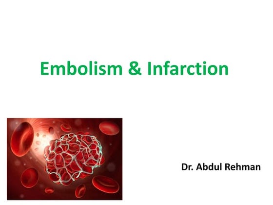 Infarction pathology lecture medical.pptx