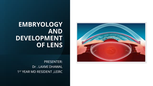 Congenital defects of the lens | PPT