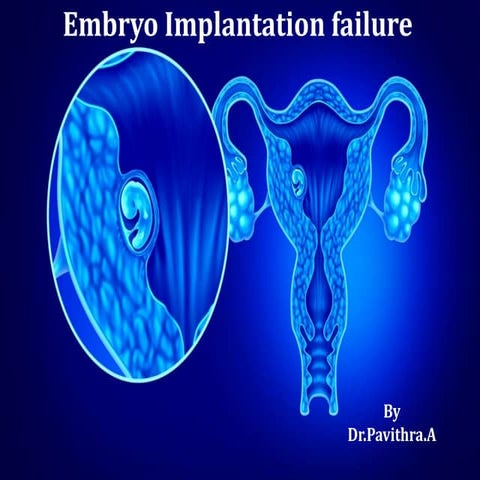 embryo implantation failure.pptx