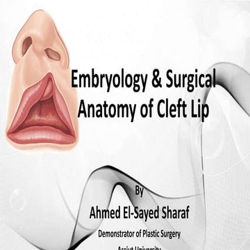 Embryology & Surgical Anatomy of Cleft Lip.pptx