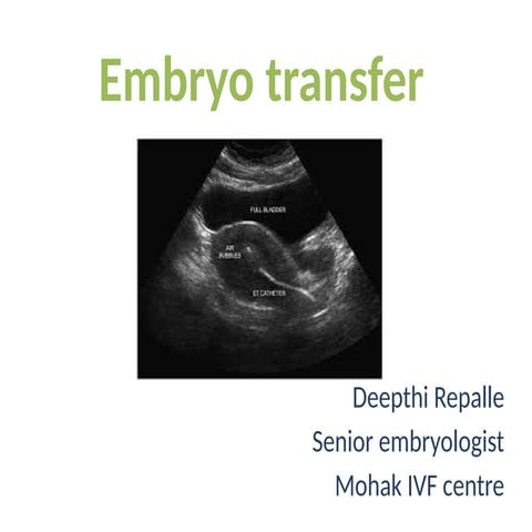 Embryo transfer AND ITS IMPORTANCE IN IVF.pptx