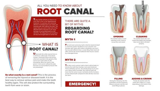 Pro's and Con's of Invisalign and Braces | PDF