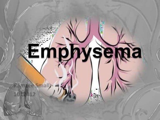 Emphysema.pptxjhyg87tguyguyfgi7yrrdgfdyt | PPTX