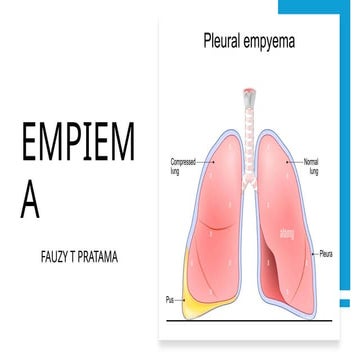 Pleural Empiema in Pulmonology terapi dan diagnostic | PPTX