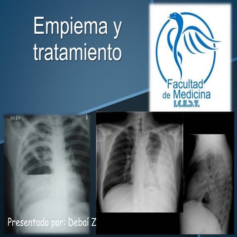 empiema diagnostico y tratamiento | PPTX