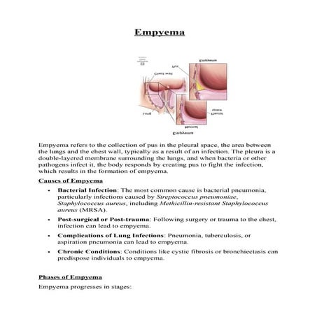 Empyema.docx of general medicine subject | DOCX