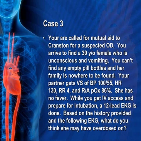 ELECTROCARDIOGRAPHY EXAMPLE questions.pptx