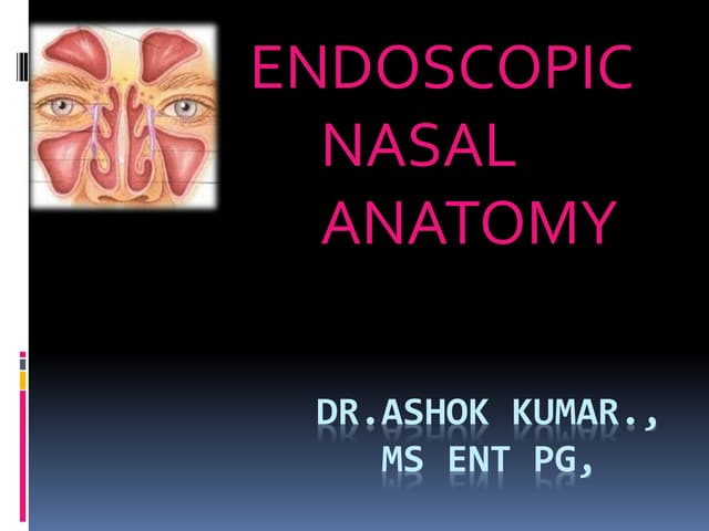 All about uncinate process of nose and paranasal sinuses | PPTX