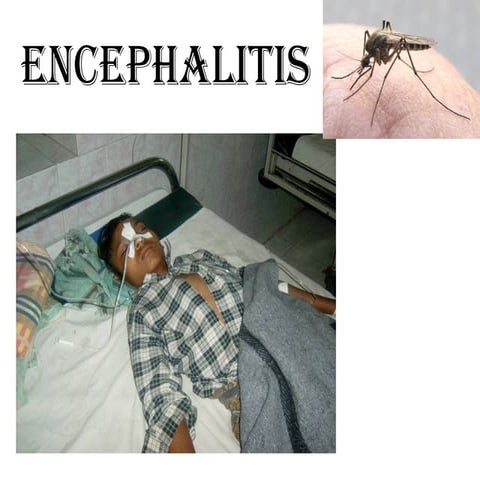 Japanese Encephalitis | PPTX